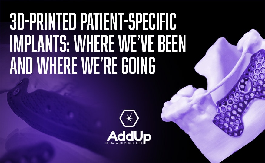 3D-Printed Patient-Specific Implants: Where We’ve Been and Where We’re ...