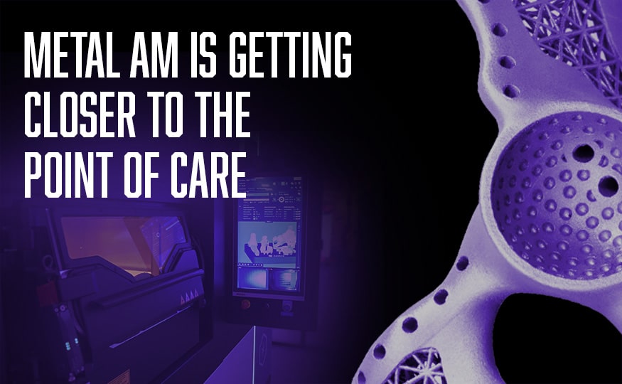 METAL ADDITIVE MANUFACTURING IS GETTING CLOSER TO THE POINT OF CARE - AddUp